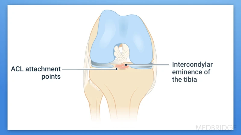 ACL Injury Prevention and Performance Enhancement Program Part 1 ...