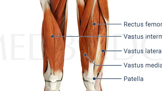 Is VMO Training Truly the Gold Standard in PFPS Treatment? | Medbridge