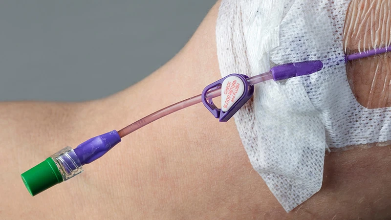 PICC Line Removal: Techniques, Tips, and Troubleshooting | Medbridge