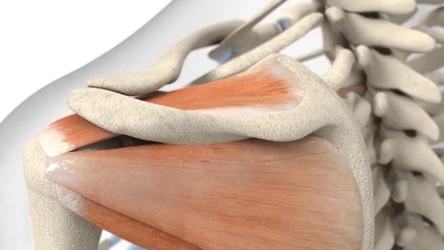 9 Best Scapular Exercises to Perform for Shoulder Impingement (and 4 ...