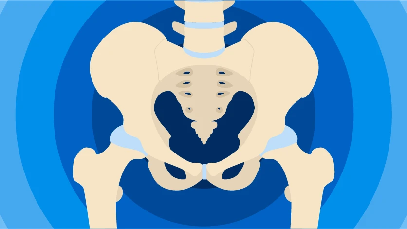 Total Hip Replacement: 3 Exercises for an Earlier Return of Functional ...
